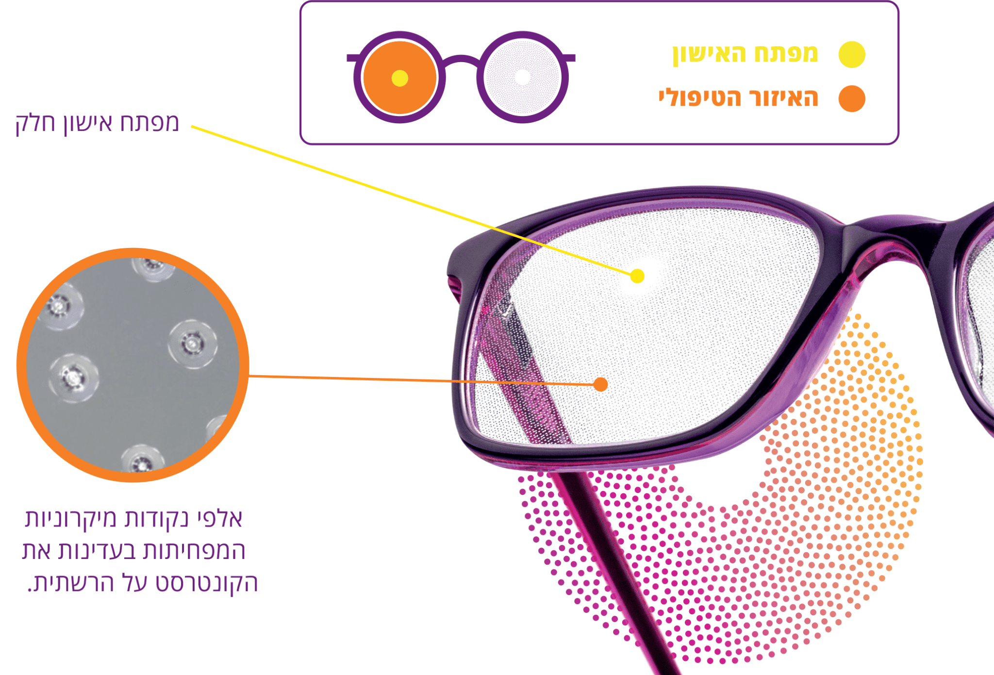 משקפיים שמאטים את עליית המספר - MiSight, MyoCare, MiYOSMART - אופטיקה דורון